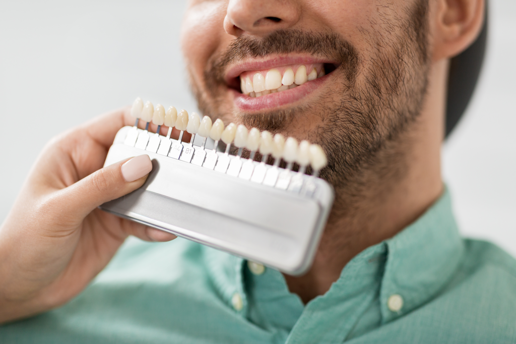 Porcelain Veneers | Mountain View Dental | Alamogordo, NM 88310